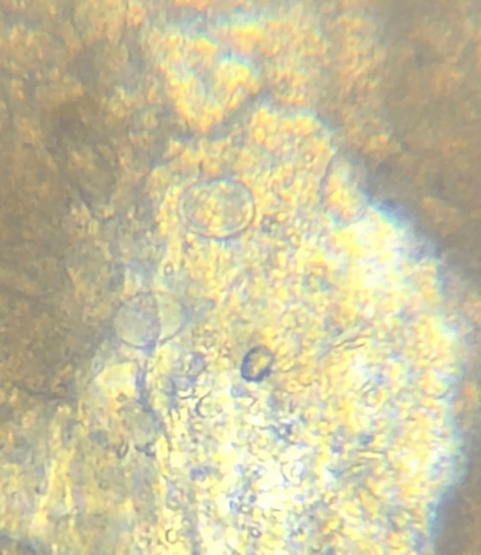 The Official Secret On How To Identify Parasites And Coccidia - Homely Hens
